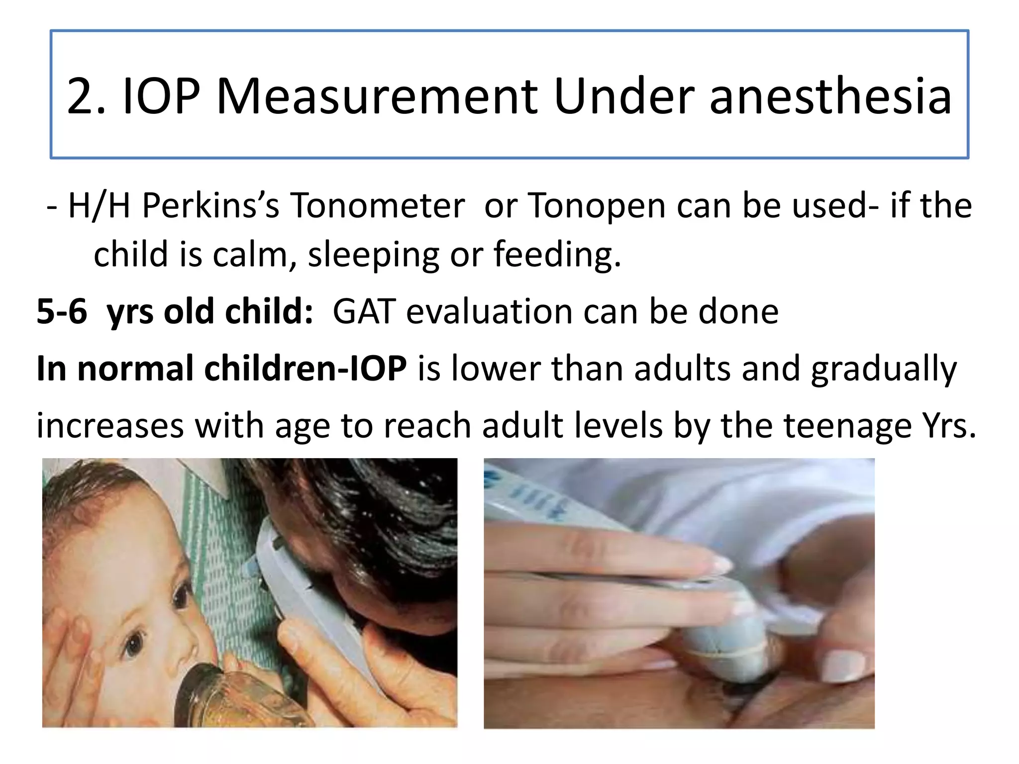 Congenital Glaucoma-Optometric managment.ppt