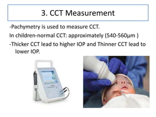 Congenital Glaucoma-Optometric managment.ppt