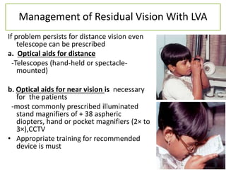 Congenital Glaucoma-Optometric managment.ppt