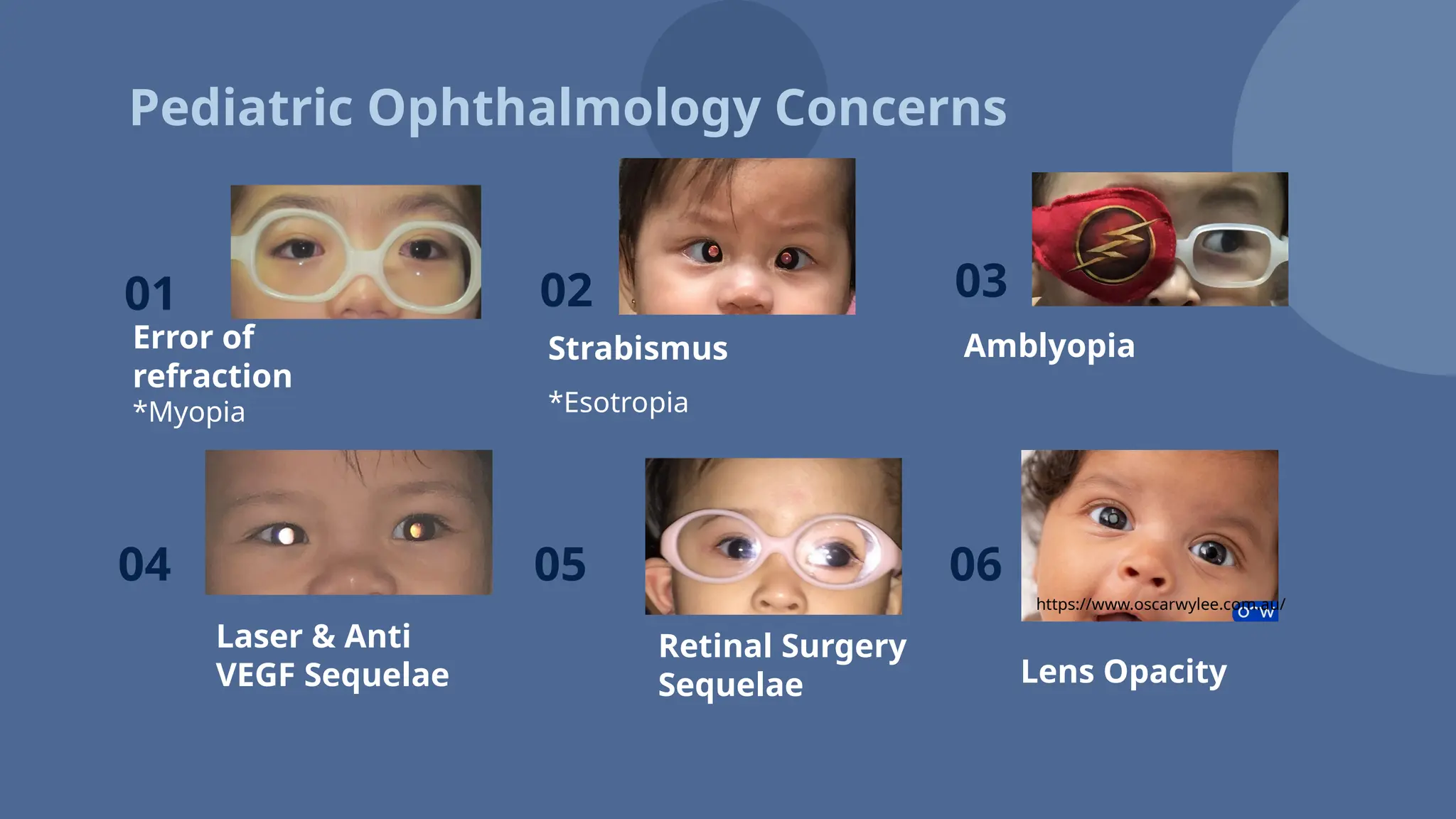 Pediatric Ophthalmology Concerns after ROP | PPTX