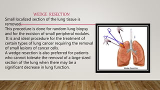 Thoracic surgery and it's management | PPTX
