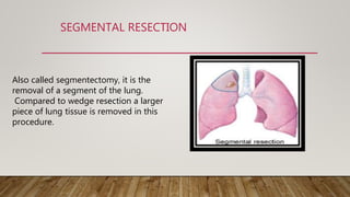 Thoracic surgery and it's management | PPTX