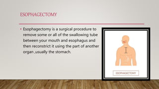 Thoracic surgery and it's management | PPTX