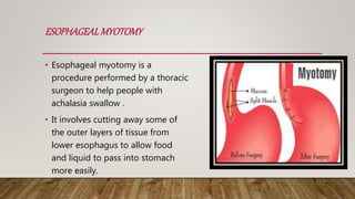 Thoracic surgery and it's management | PPTX