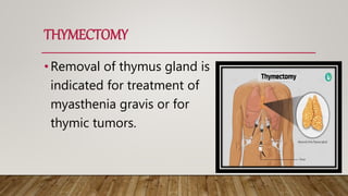 Thoracic surgery and it's management | PPTX