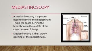 Thoracic surgery and it's management | PPTX
