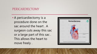 Thoracic surgery and it's management | PPTX