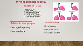 Thoracic surgery and it's management | PPTX