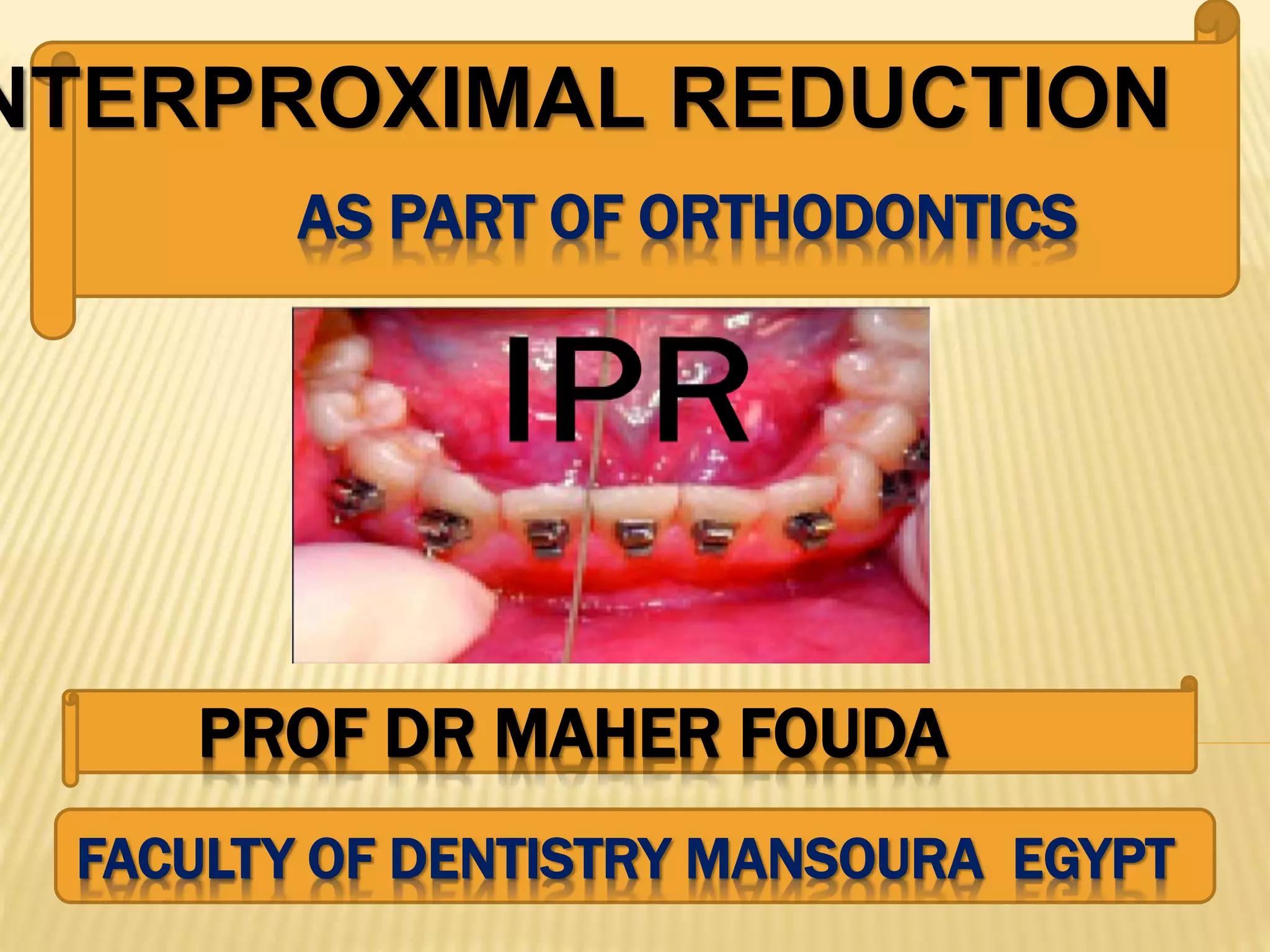 interproximal reduction of enamel as part of orthodontics | PPTX