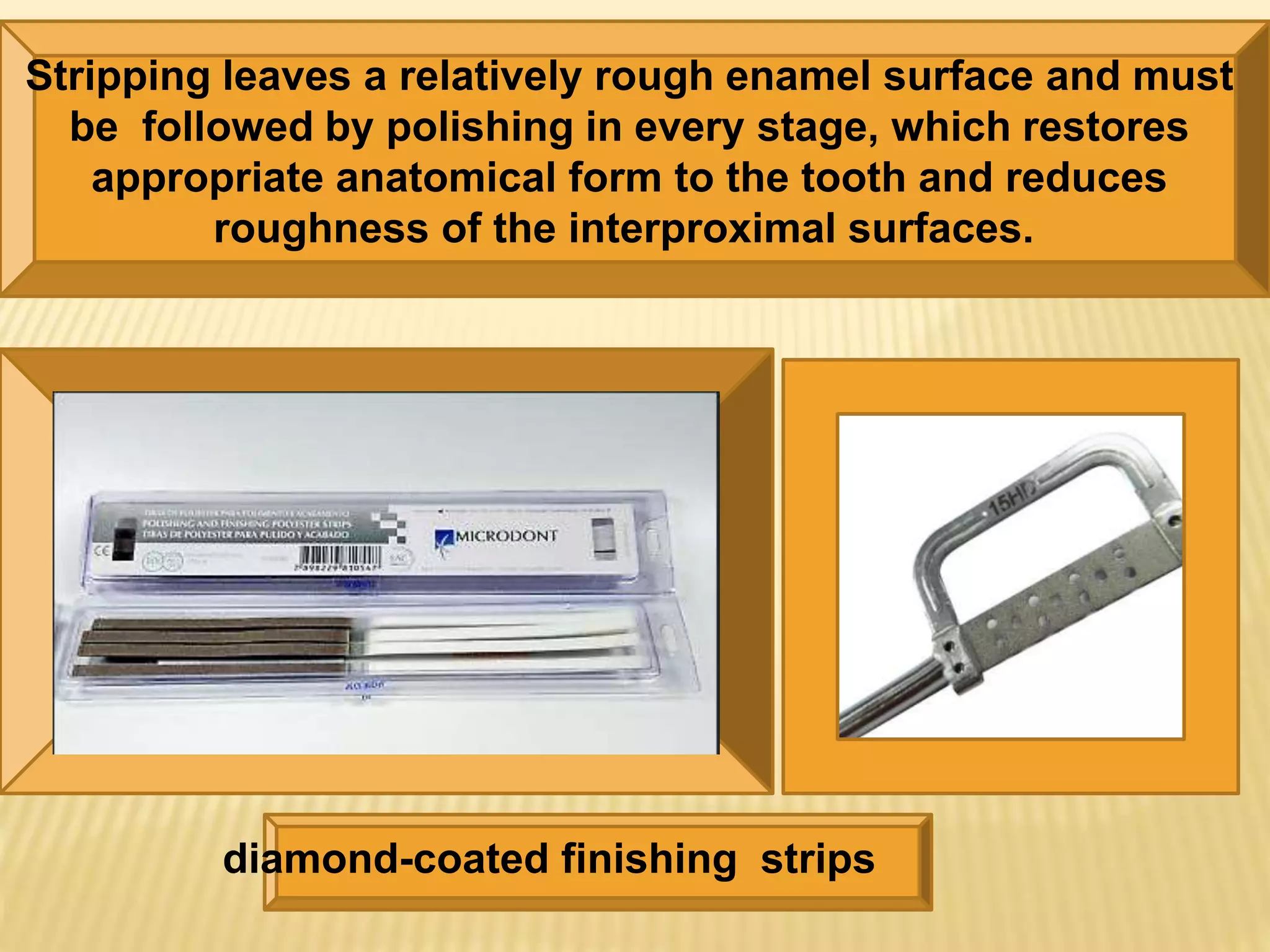 interproximal reduction of enamel as part of orthodontics | PPTX