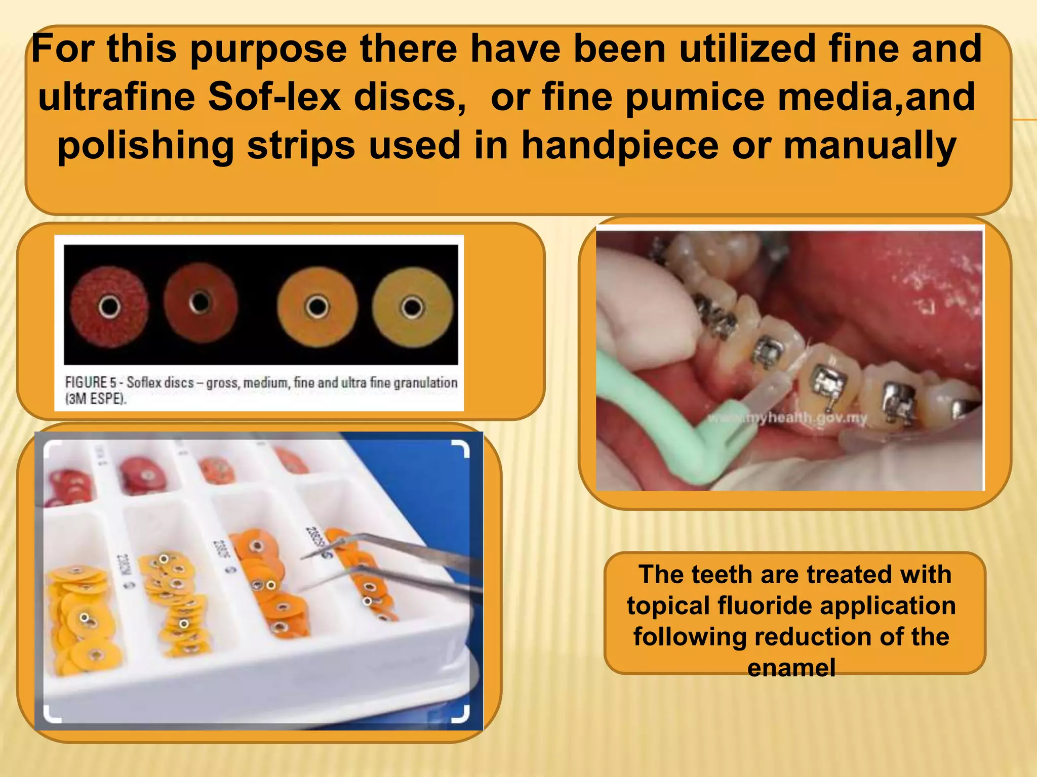interproximal reduction of enamel as part of orthodontics | PPTX