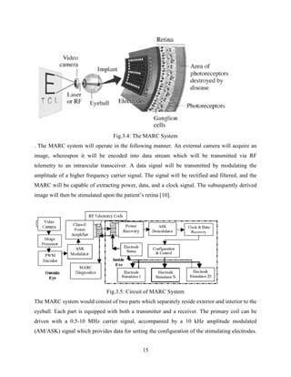 Final aartifical eye seminar report march2016 | PDF