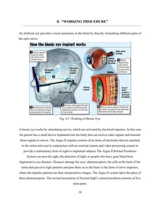 Final aartifical eye seminar report march2016 | PDF