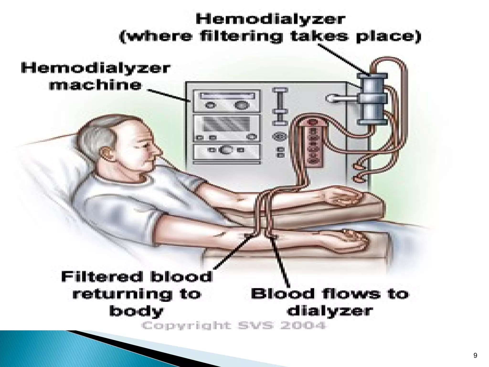 Dialysis | PPT