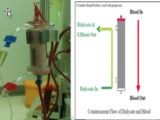 Dialysis | PPT