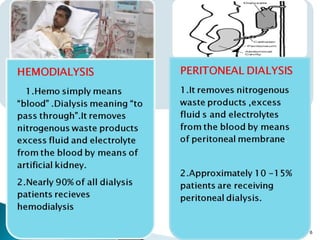 Peritoneal Dialysis Vs Hemodialysis
