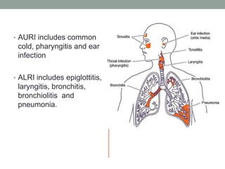 Final acute respiratory infections.pptx