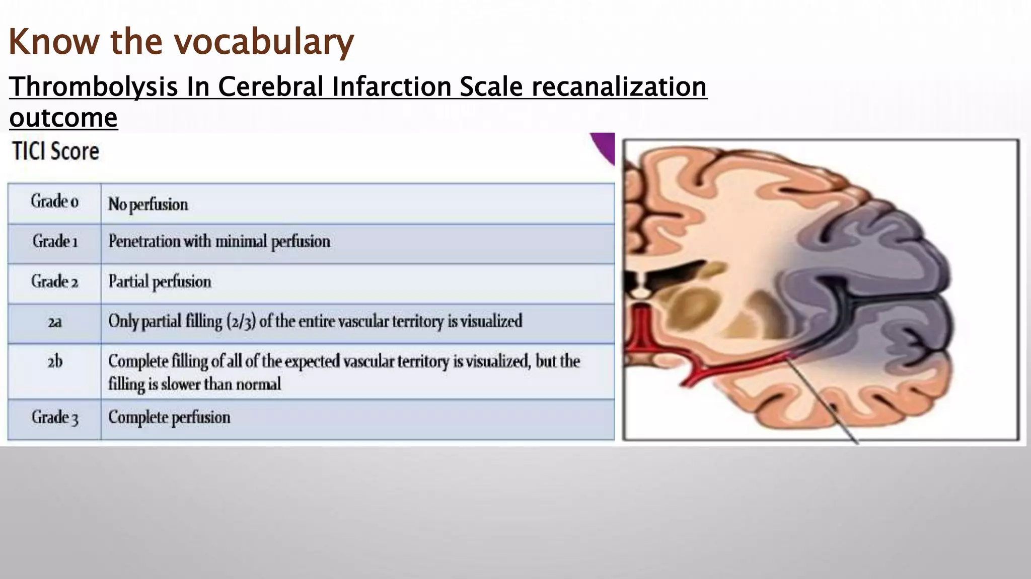 Recent Advances In Thrombolysis In Stroke Patient | PPTX