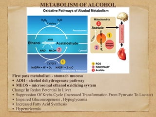 ALCOHOLIC LIVER DISEASE | PDF