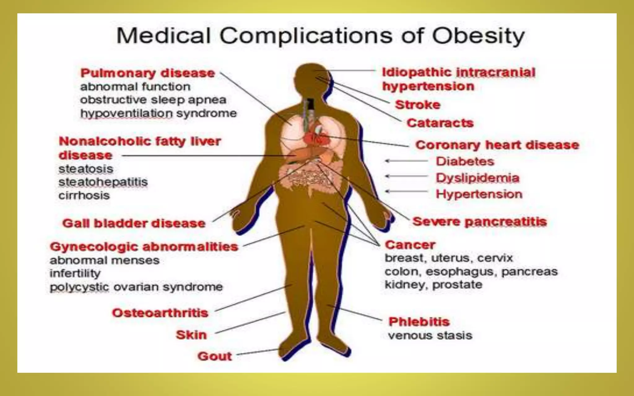 ANAESTHETIC CONSIDERATION FOR MORBID OBESITY FOR NON BARIATRIC SURGERY ...