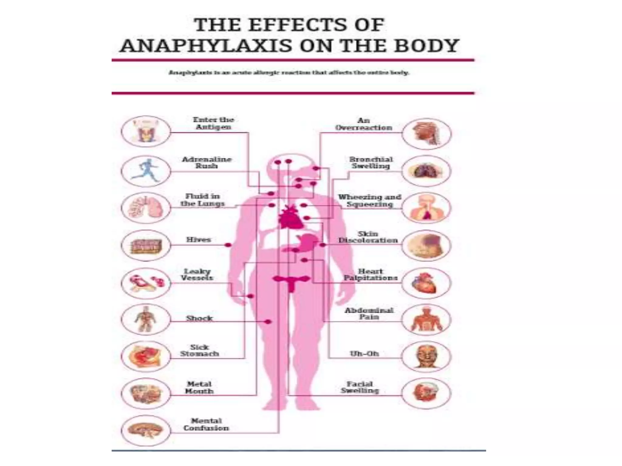 Final anaphylactic reactions and anaphylactic shock | PPTX