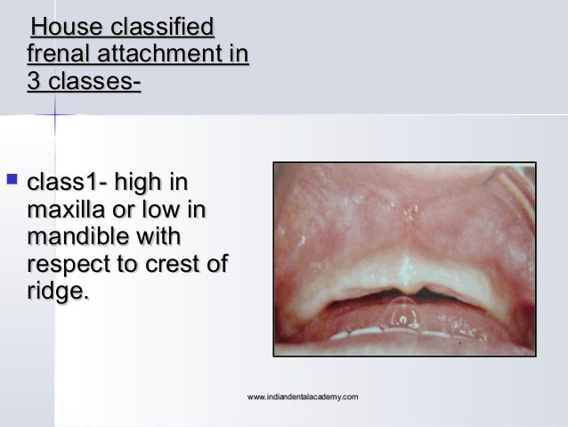 Final anatomic landmarks/ online orthodontic courses