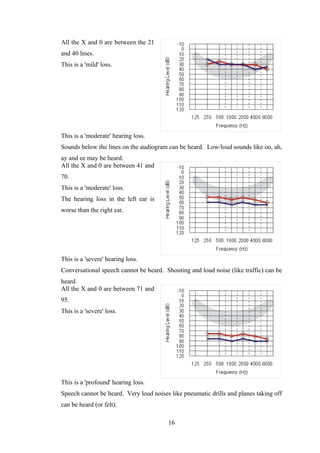 First Language Acquisition in hearing impaired children with cochlear ...