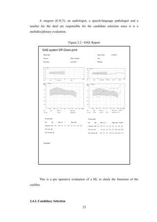 First Language Acquisition in hearing impaired children with cochlear ...