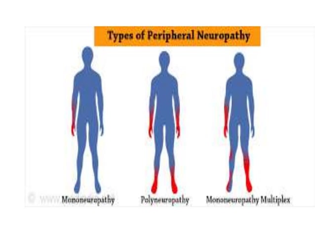 approach to polyneuropathy | PPTX