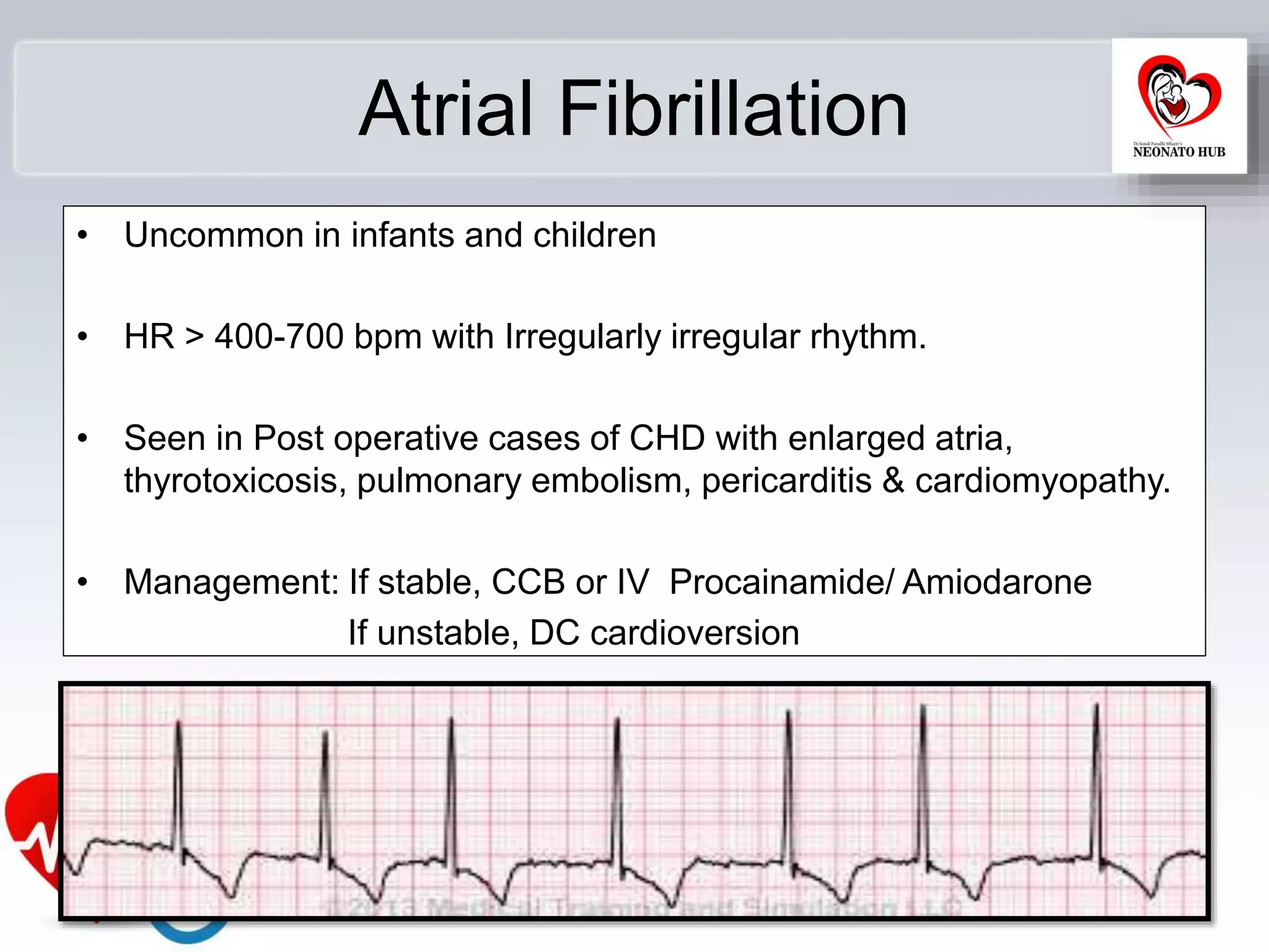 Pediatric Arrythmias | PPT