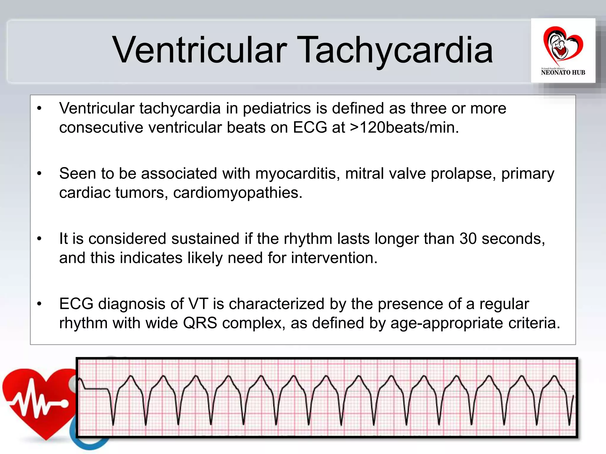 Pediatric Arrythmias | PPT