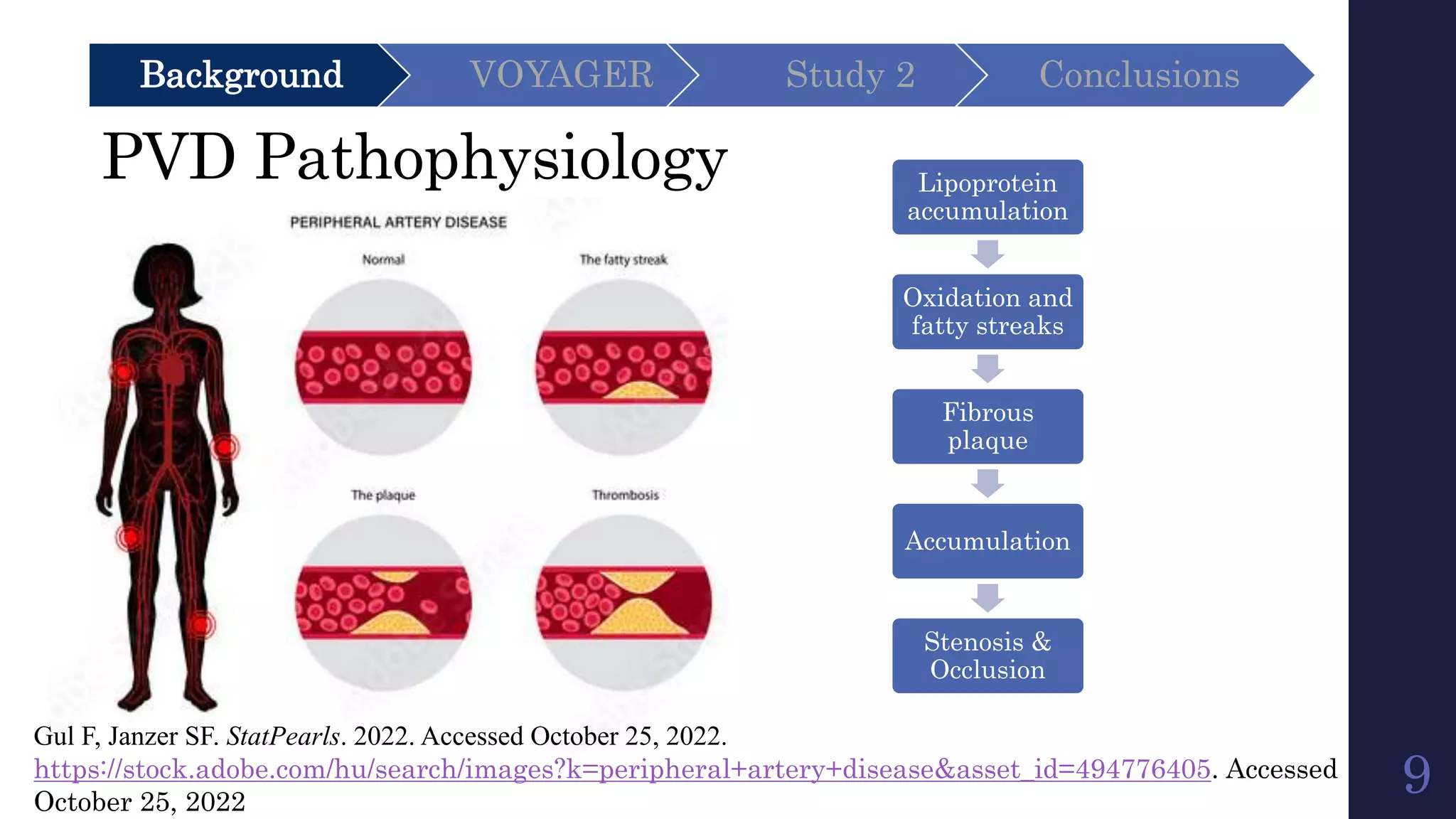 Final_ASandler_PVD_Anticoag patient case.pptx