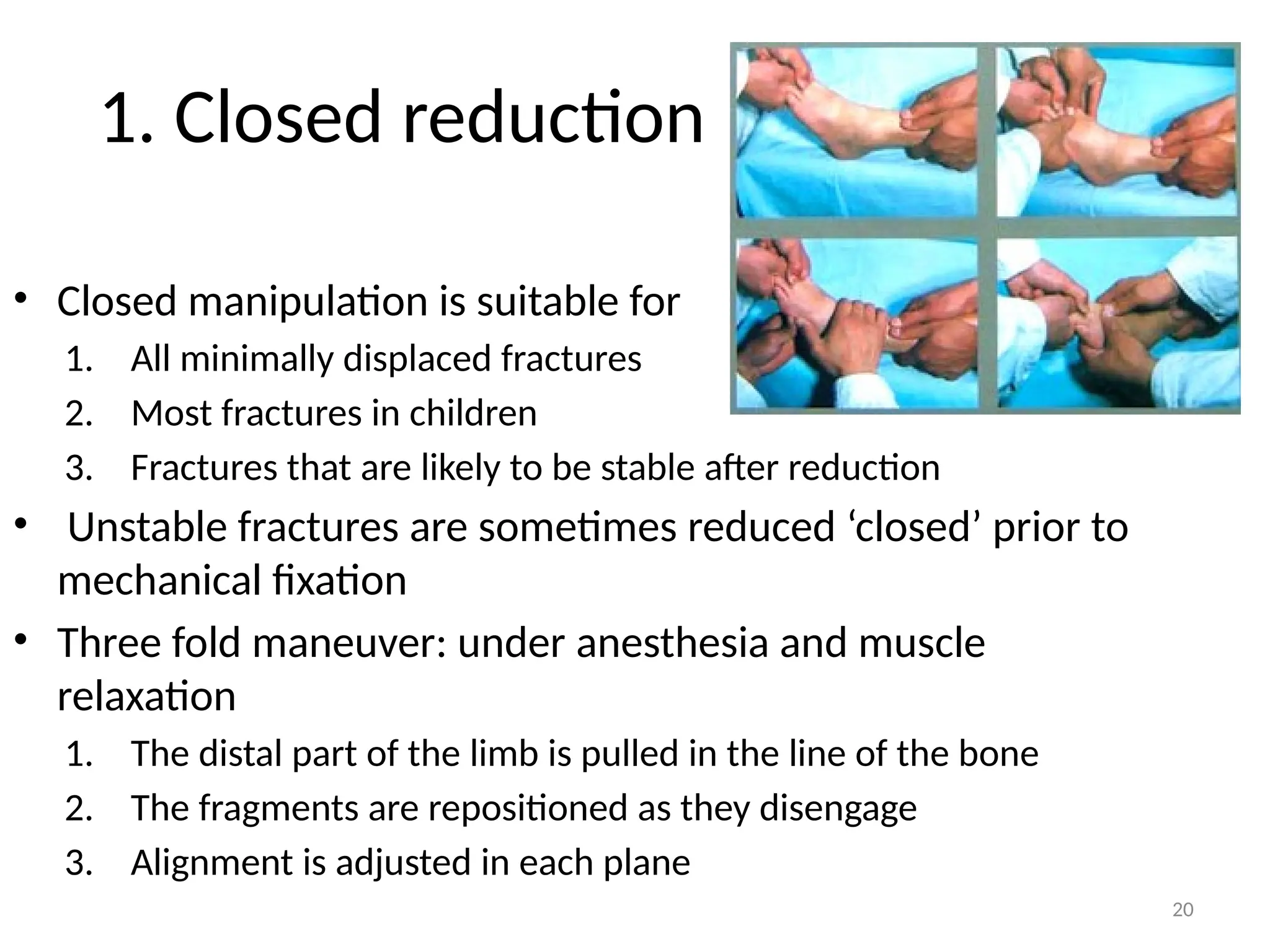 final Basic principles and management of Fractures and Dislocations.pptx