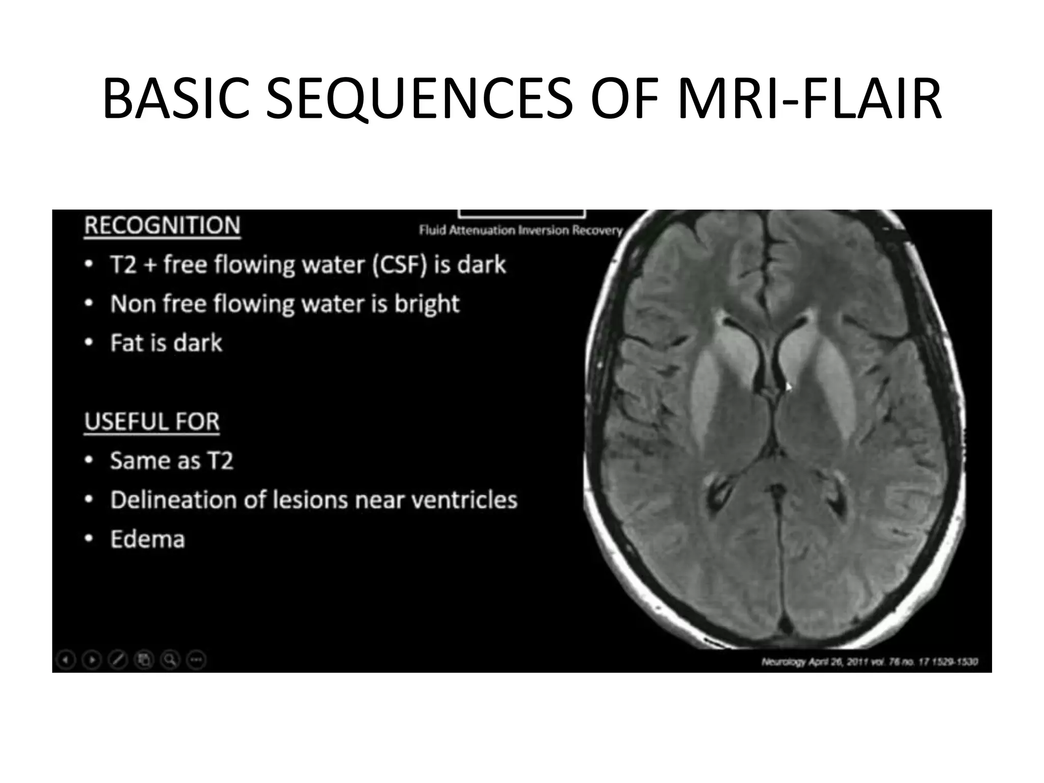 Final basic principles of mri icl | PPT