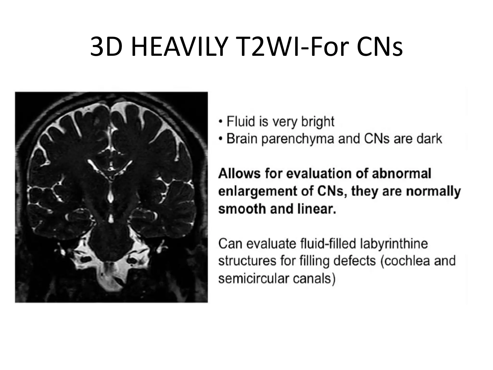 Final basic principles of mri icl | PPT