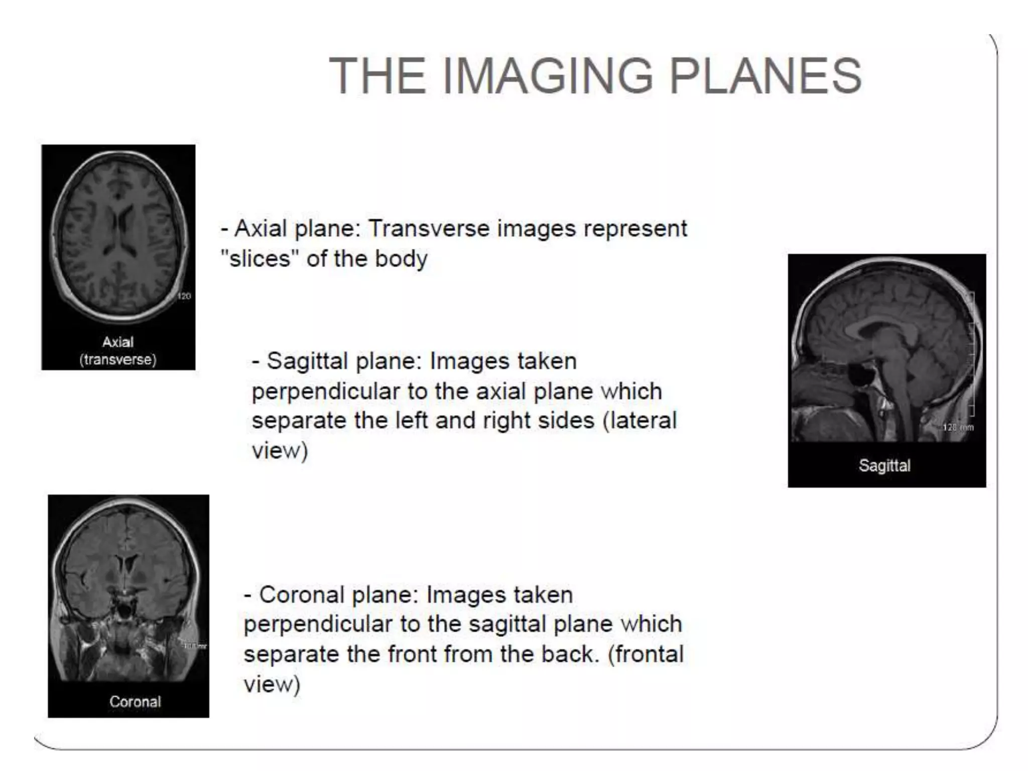 Final basic principles of mri icl | PPT