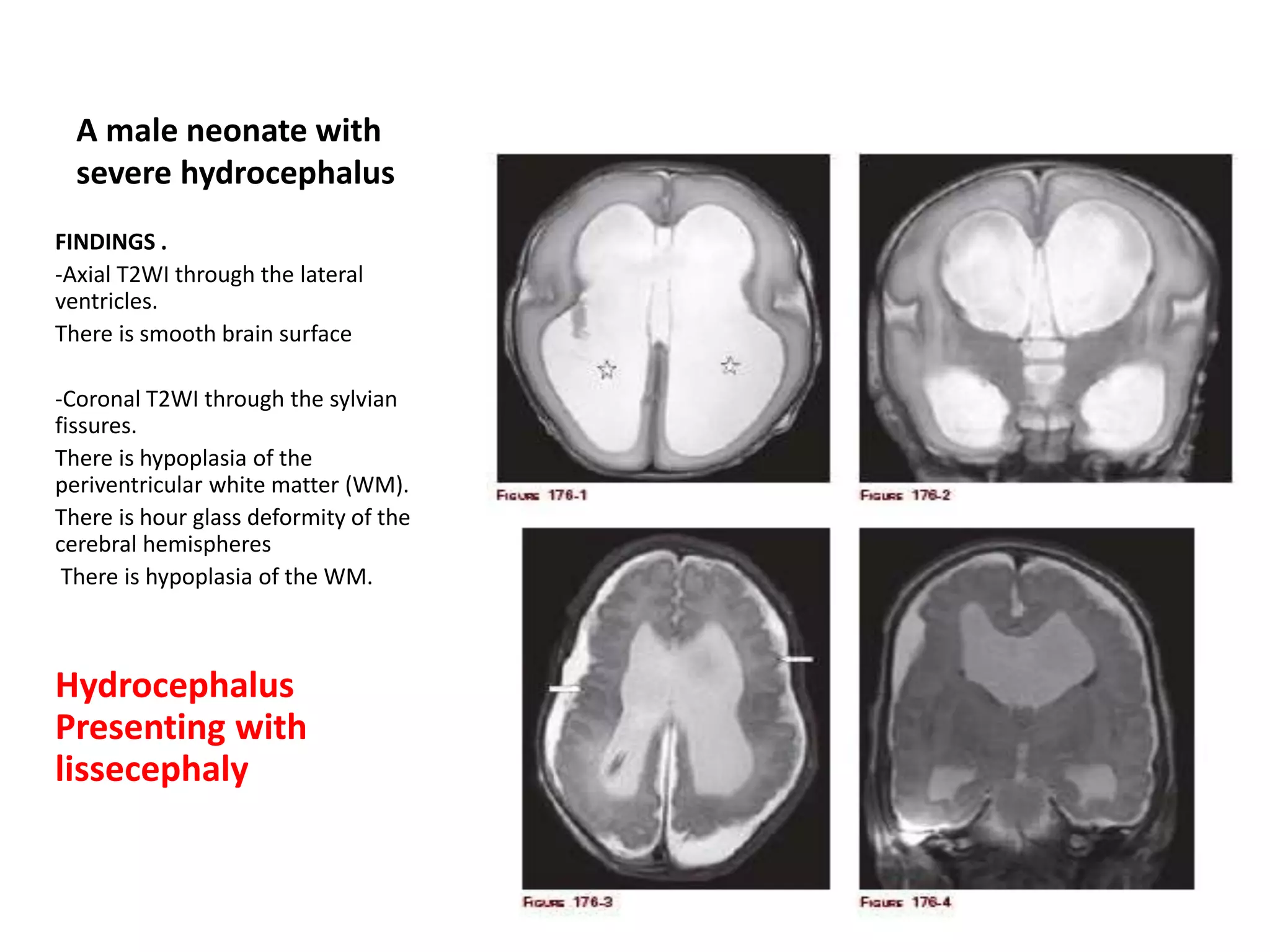 Final basic principles of mri icl | PPT