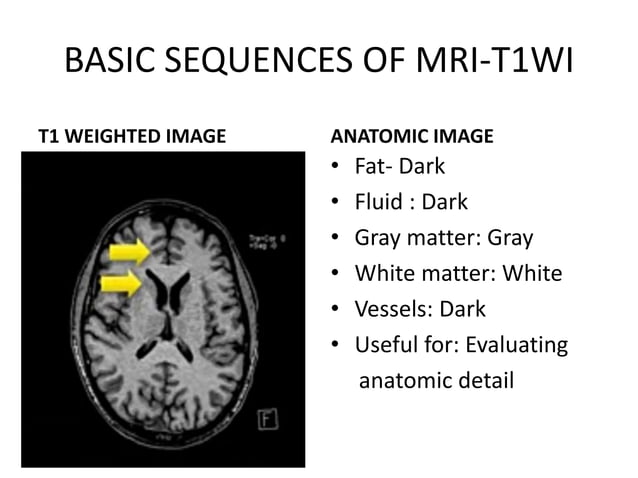 Final basic principles of mri icl | PPT