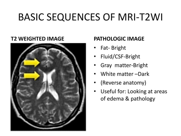 Final basic principles of mri icl | PPT