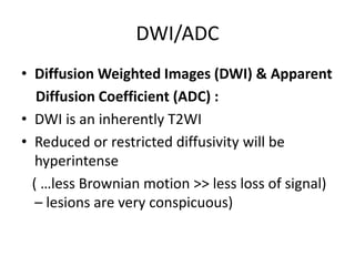 Final basic principles of mri icl | PPTX