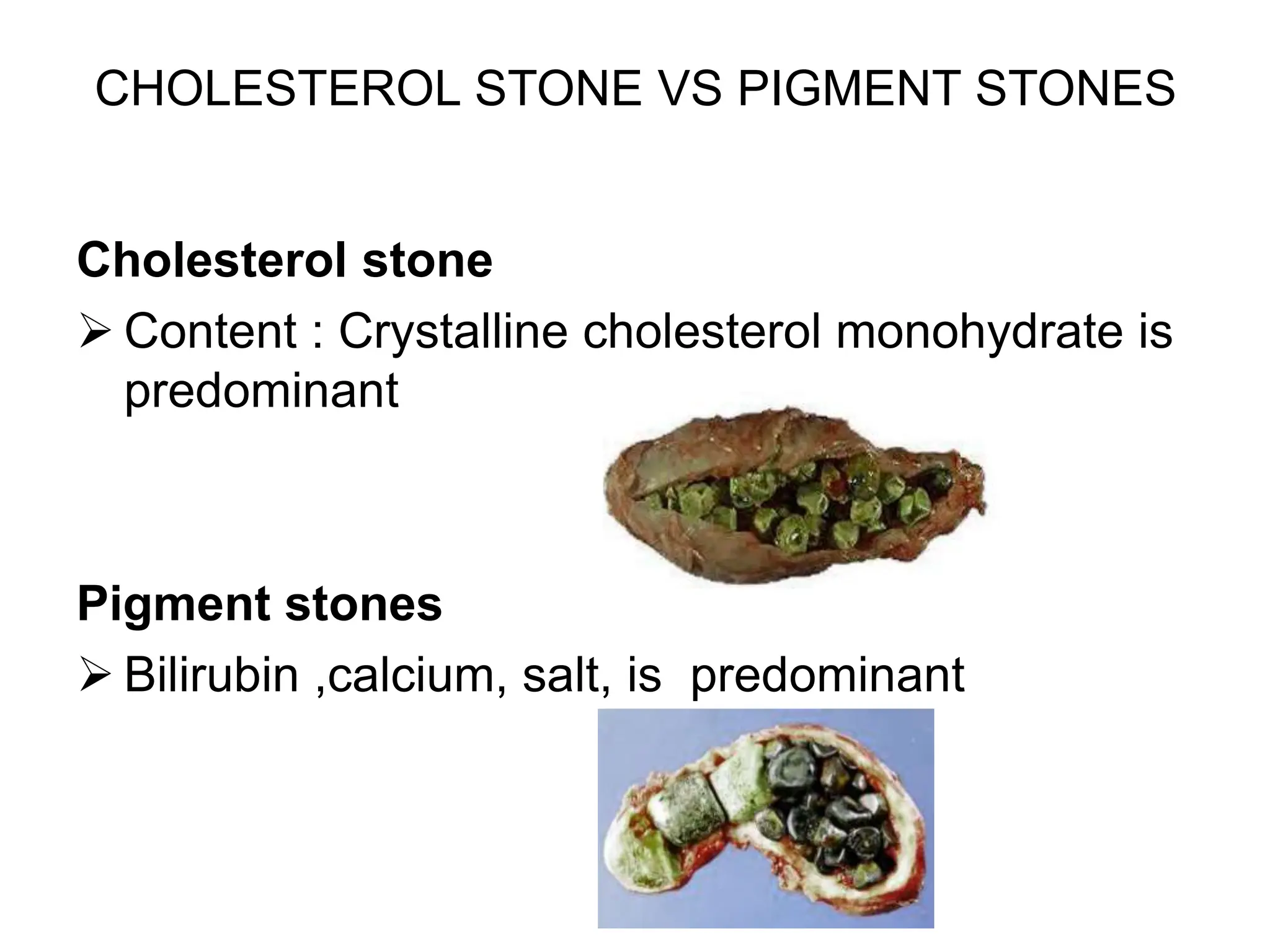 final BILIARY Disorders presentation.pptx