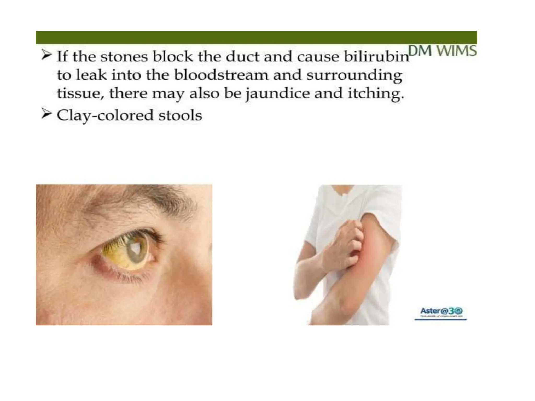 final BILIARY Disorders presentation.pptx