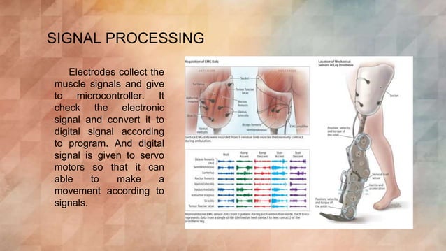 Acrylic Prosthetic Limb Using EMG signal | PPT