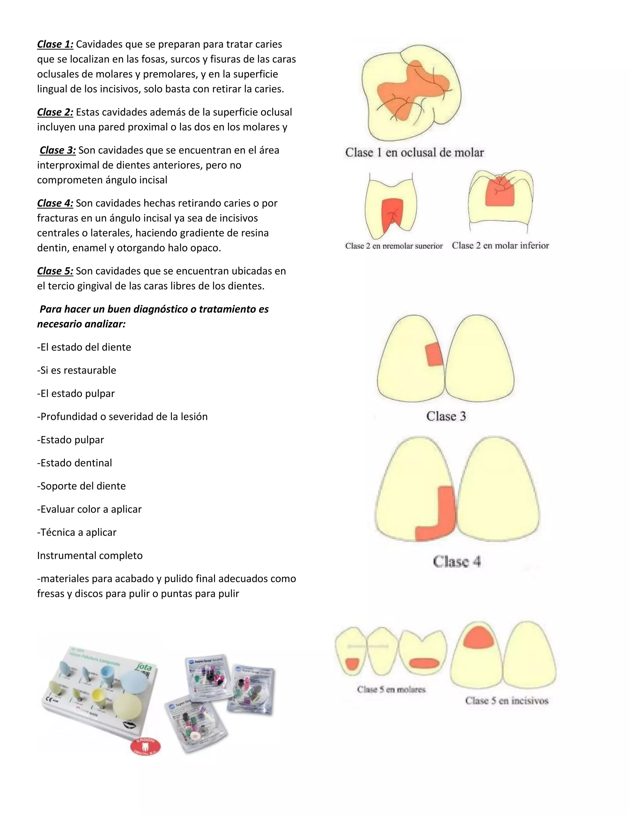 clasificacion de cavidades para resina segun BLACK | PDF