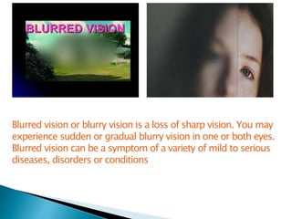 Blurred vision.pptx