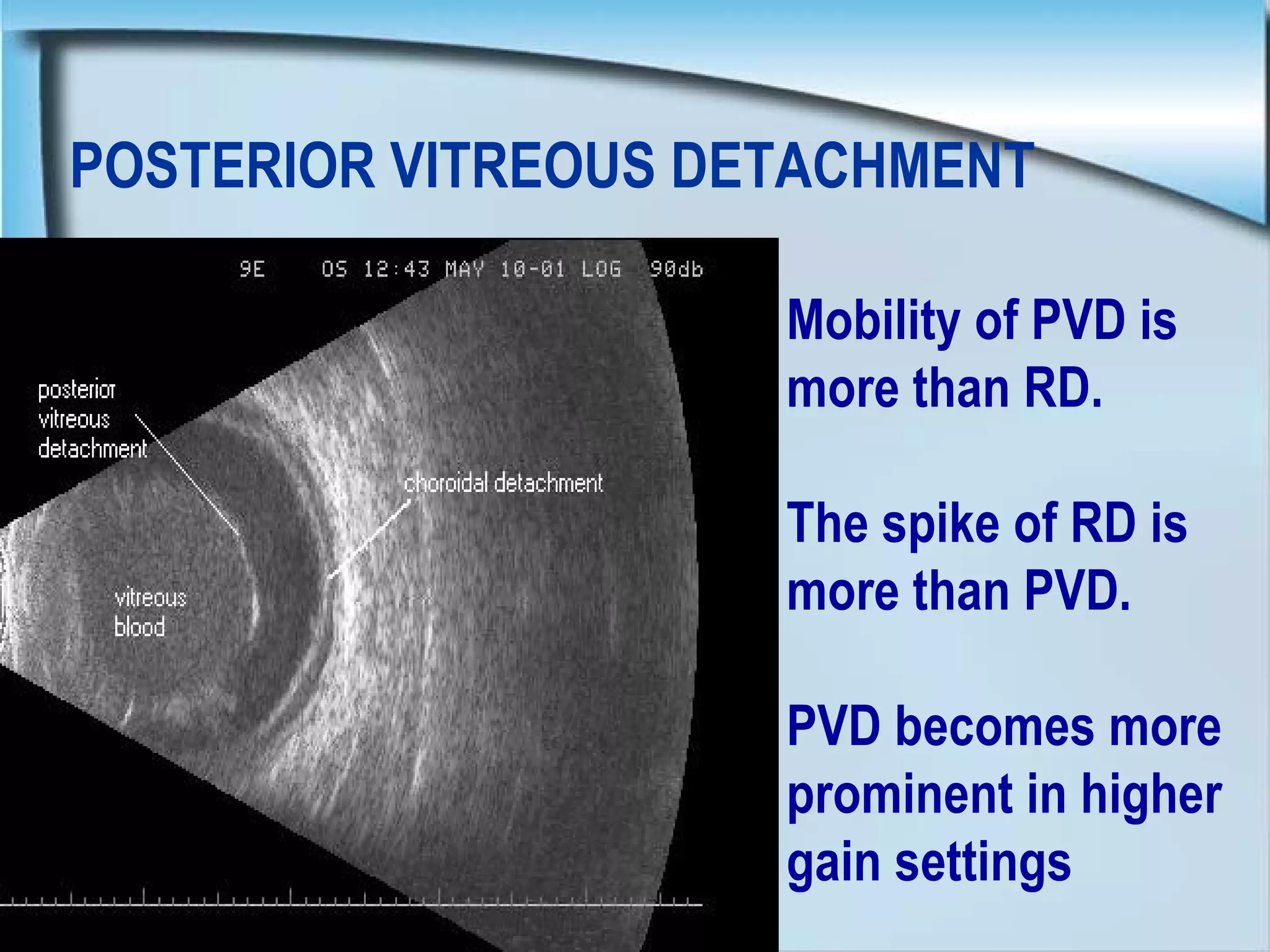B SCAN | PPT