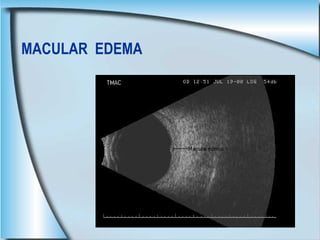 B SCAN | PPT