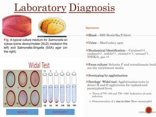 Final blood stream infection, department of microbiology | PPT