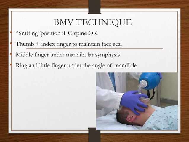 Bag and Mask Ventilation By Sakun Rasaily, Sr. Staff Nurse & Ram Kumar Dhamala | PPTX