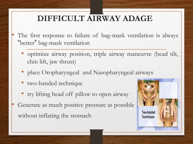 Bag and Mask Ventilation By Sakun Rasaily, Sr. Staff Nurse & Ram Kumar Dhamala | PPTX